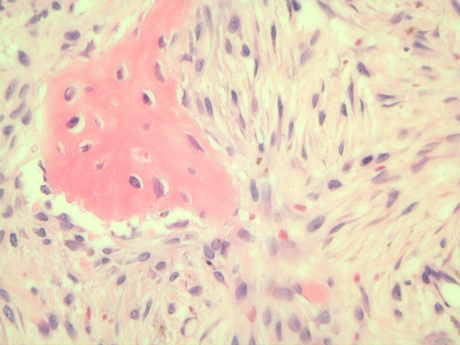 Cases: Neoplastic Bone Pathology