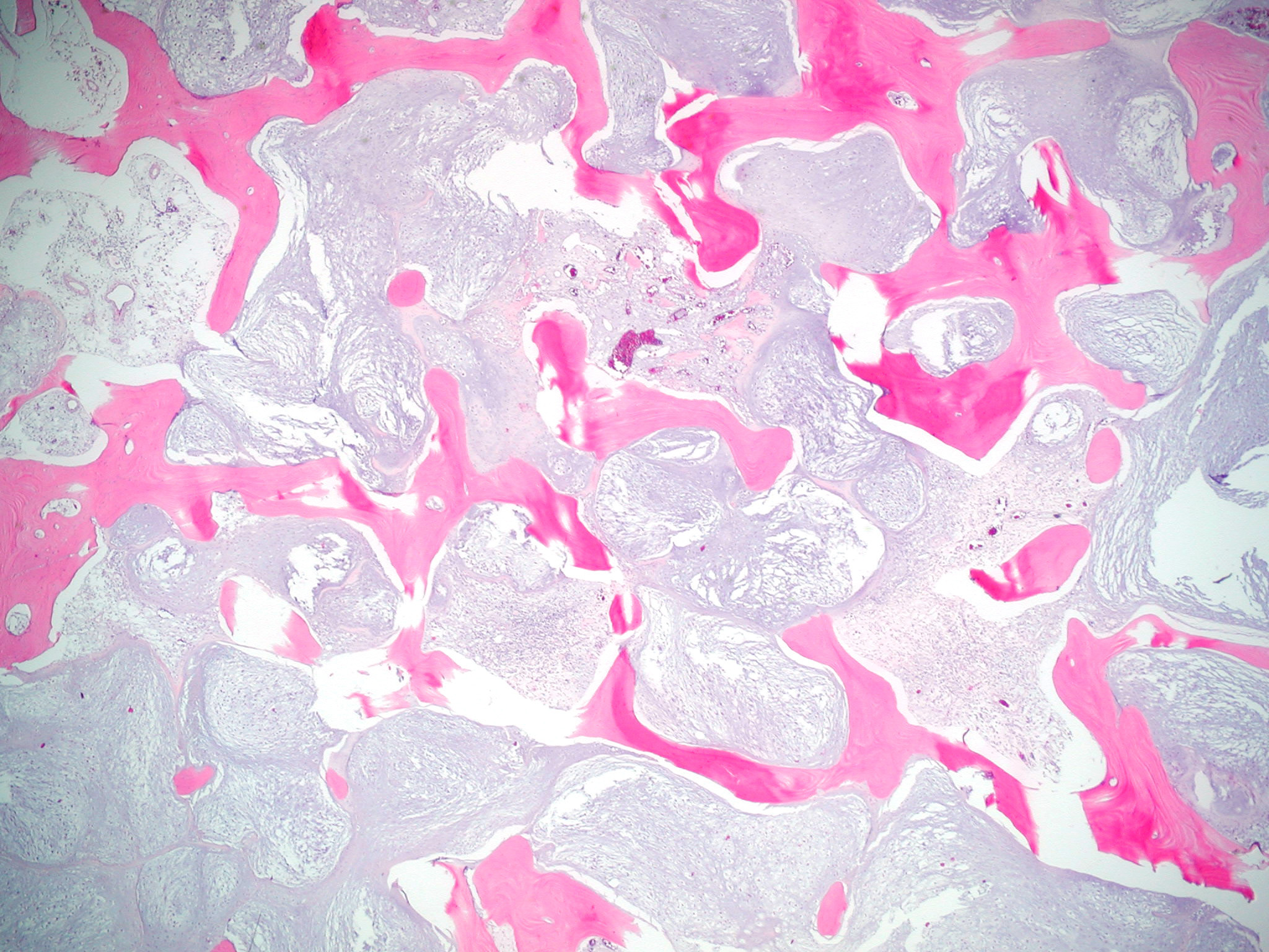 Cases: Neoplastic Bone Pathology