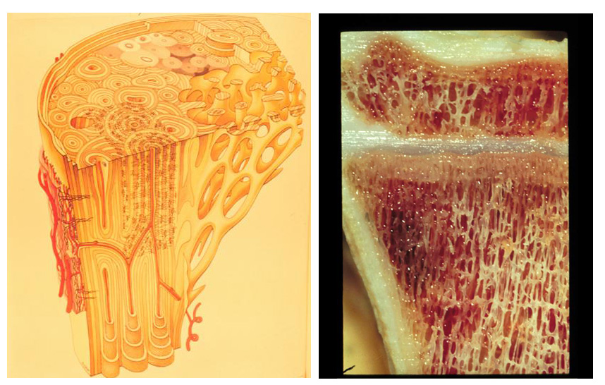 Cases: Non-neoplastic Bone Pathology