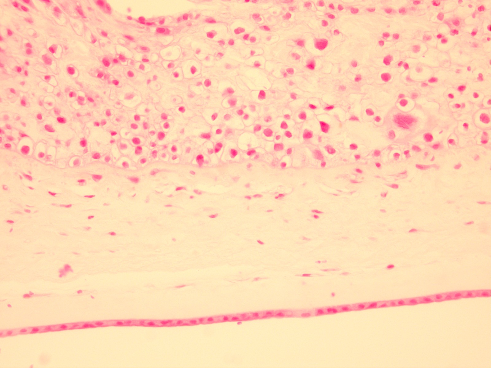 Cases: Histology of Placenta